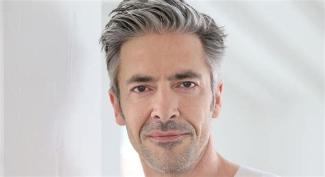 Male Blepharoplasty Charlotte Nc Charlotte Plastic Surgery