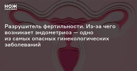 Эндометриоз — Нож