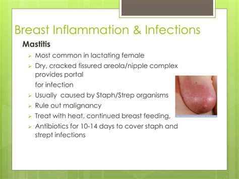 Benign Breast Diseases Pptx
