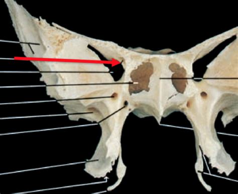 Sphenoid Bone Flashcards Quizlet