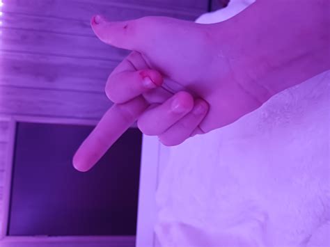 Best Keyboard Bracket Bracketfights