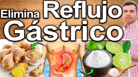 Como Quitar El Reflujo Reflujo Gastroesofágico Causas Vqtzlh