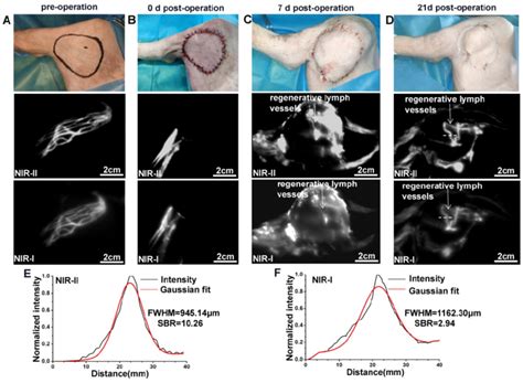Nir Imaging For Monitoring Lymphatic Reconstruction In The Saphenous Download Scientific