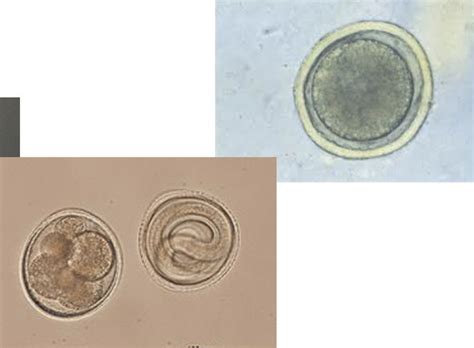 DIAGNOSTICS Midterm Lab Pract Flashcards Quizlet DIAGNOSTICS Midterm Lab Pract Flashcards Quizlet