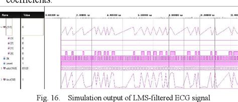 figure 16 from design of efficient adaptive lms filter for noise