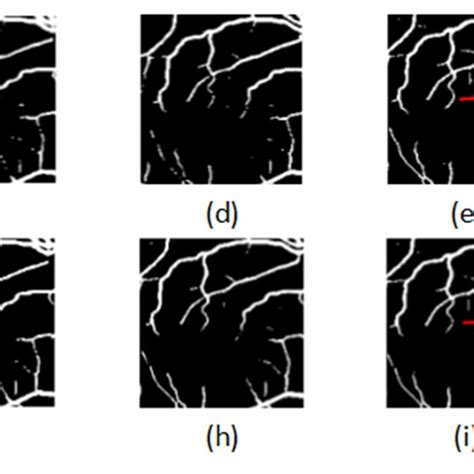 Qualitative Performance Comparison Between The Semi Supervised And