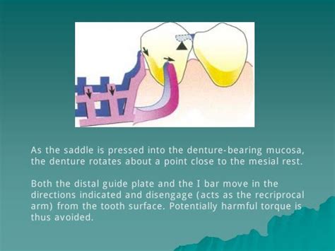 Rpi The Rpi System Is Des