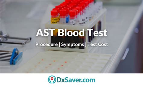 AST Blood Test Liver Health Procedure Preparation And Test Cost