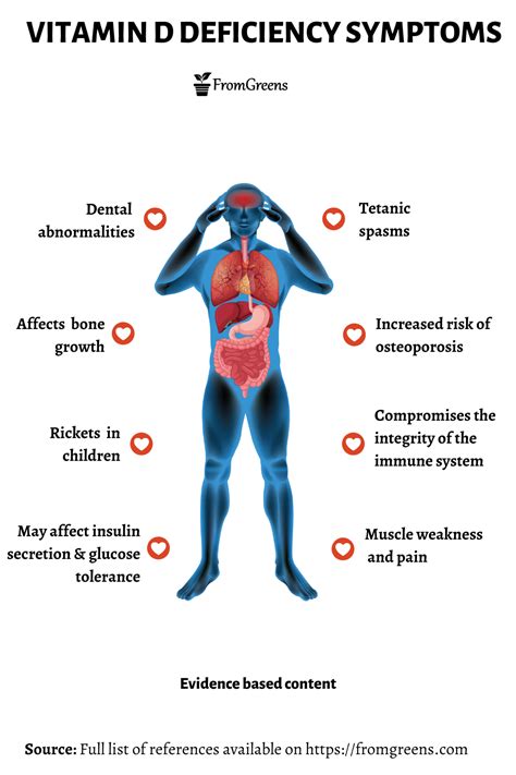 Effects Of Vitamin D Deficiency Rmgd