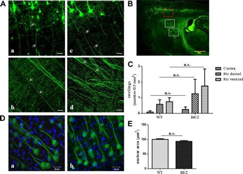 R6 2 Mice Have Normal Cell Bodies And No Obvious Axon Abnormality Download Scientific Diagram