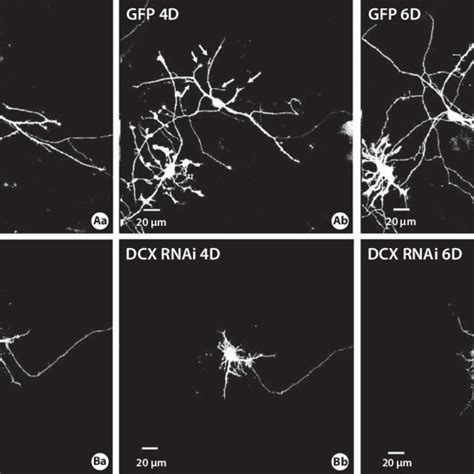 Time Lapse Imaging Of Older Neurons Transfected At 8 Div Aa Ac Download Scientific Diagram