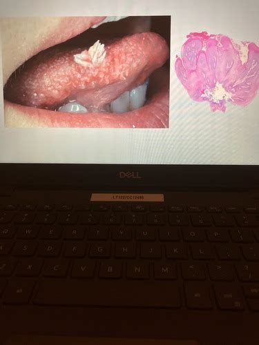 Ch 7 Pt 1 Photos Flashcards Quizlet