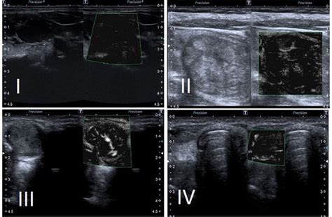 Schematic Of Classification Based On The Distribution Patterns Of Download Scientific Diagram