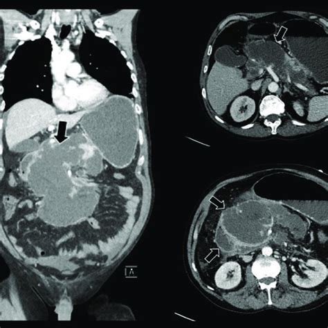 Computed Tomography Ct Imaging Of The Abdomen With Intravenous Download Scientific Diagram