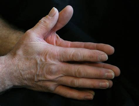 Warning Signs Of Hand Tendonitis And How To Prevent It