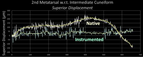 example bone relative motion as determined by dic vision tracking