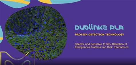 Video Alejandra Krasniewski On Linkedin Duolink® Proximity Ligation Assays Pla Enable The