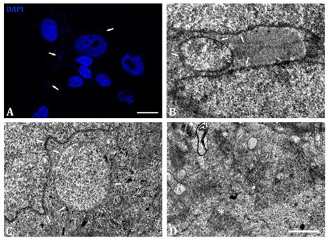 Hp1γ Prevents Activation Of The Cgas Sting Pathway By Preserving Nuclear Envelope And Genomic
