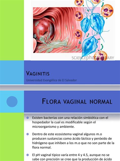 Causas Y Tratamientos De Vaginitis Pdf Vagina Especialidades Medicas