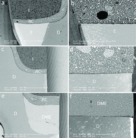 Sem Micrographs Of Nanoleakage Determined In The Interfaces Created Download Scientific Diagram