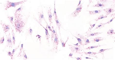 Counting Puncta In Qupath Image Analysis Image Sc Forum
