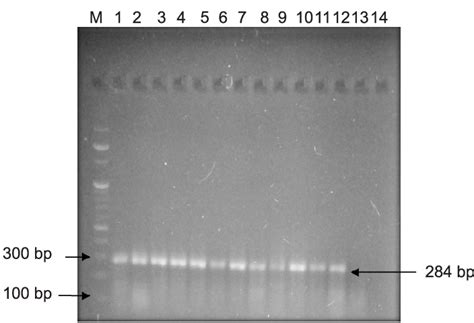 Polymerase Chain Reaction Pcr Amplification Of Inva Gene From Download Scientific Diagram