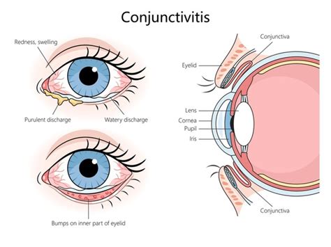 Anatomy Of The Eye Conjunctiva Anatomy Of Conjunctiva