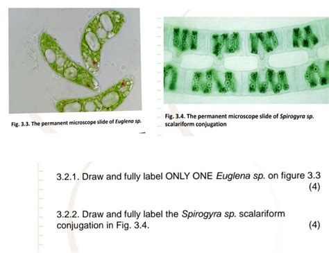 Spirogyra Microscope Slide Labeled
