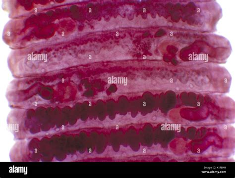 Tapeworm Proglottids In Human Stool