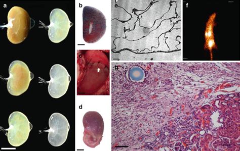 Decellularization Abdominal Key