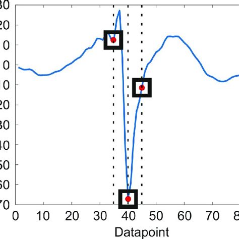 The Applied Principal Component Selection Each Potential Spike Was