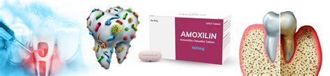 Amoxicillin For Tooth Infection Internationaldrugmart