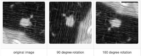 Cropped CT Scan Images Download Scientific Diagram