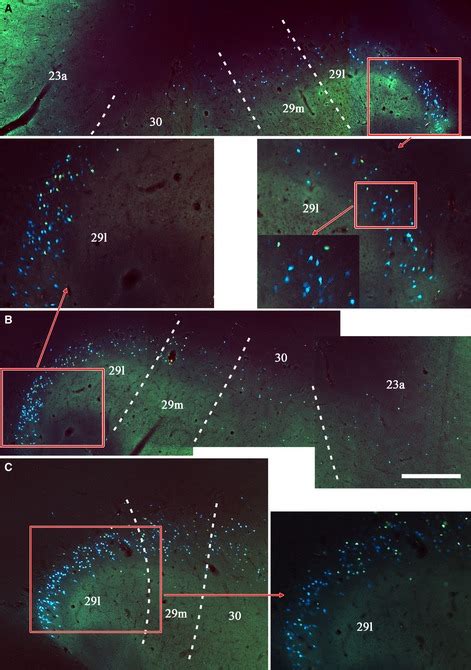 Location And Extent Of Retrograde Tracer Injections Involving The
