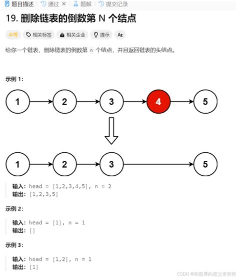 Leetcode19删除链表的倒数第k个节点（java实现）删除倒数第k个节点java Csdn博客