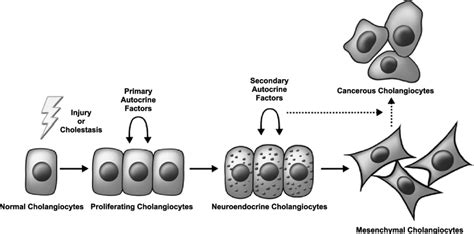 Cholangiocyte Progression Through The Course Of Biliary Damage