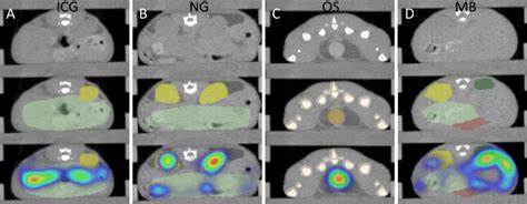 Ct Based Segmentation Top Row Ct Slice Middle Row Ct And
