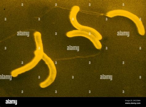 Scanning Electron Micrograph Sem Tinted Yellow Of The Comma Shaped Bacterium Vibrio