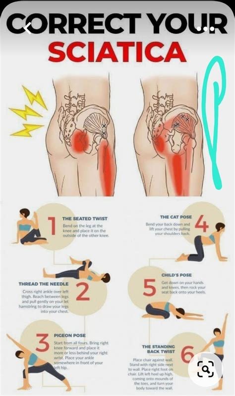 Exercises For Sciatica Artofit