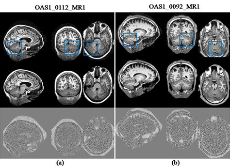 Denoised Results Of The Proposed Hosvd R Algorithm On Two Sets Of Real Download Scientific
