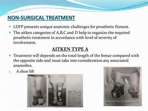 Pffd Proximal Femoral Focal Deficiency Pptx