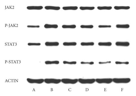 Electrophoresis Diagrams Of Jak2 P Jak2 Stat3 And P Stat3 Protein