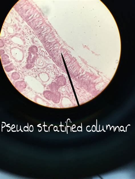 Pseudo Stratified Columnar Epithelial Tissue Nursing School Info