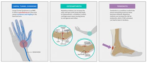 Ergonomics In Industrial Production And Packing Lines