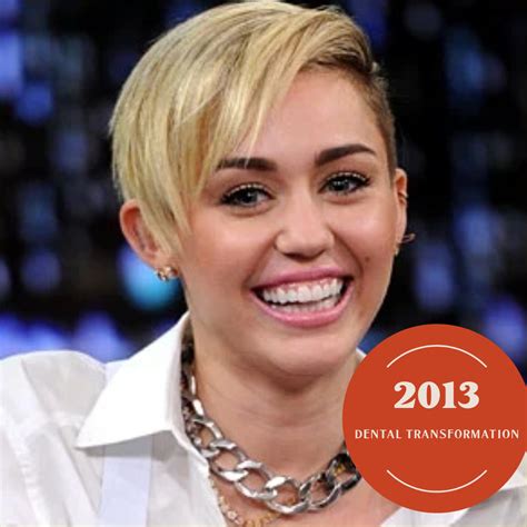 Miley Cyrus Teeth Transformation From Crooked To Stunning