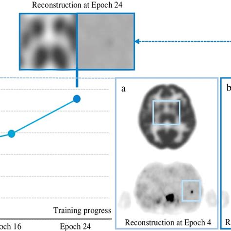 Representative Discrepancy In Reconstruction Quality Between Different