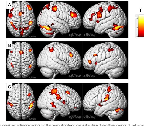 Figure 1 From Cerebral Cortex Activation During The Sternberg Verbal Working Memory Task