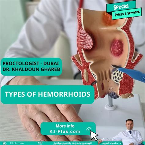 Thrombosed External Hemorrhoid Burst Haemorrhoids Piles Symptoms