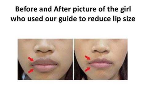 How To Get Bigger Lips Without Makeup Or Surgery Mugeek Vidalondon