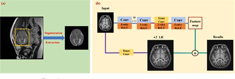 Figure 1 From Deep Robust Residual Network For Brain Mri Super